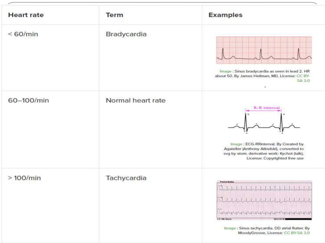 ECG Simple Approach.pptx