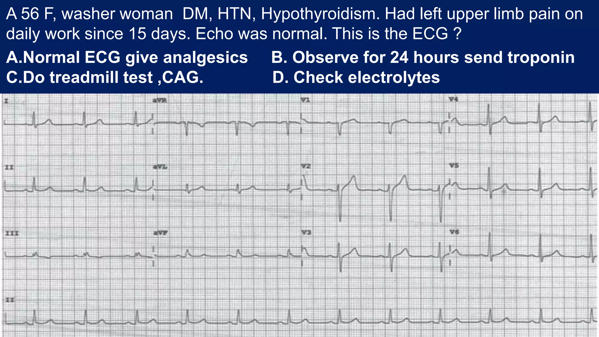 ECGs in Acute Coronary Syndrome | PPTX
