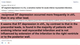 ECGs in Acute Coronary Syndrome | PPTX