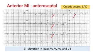 Ec gs in ami | PDF