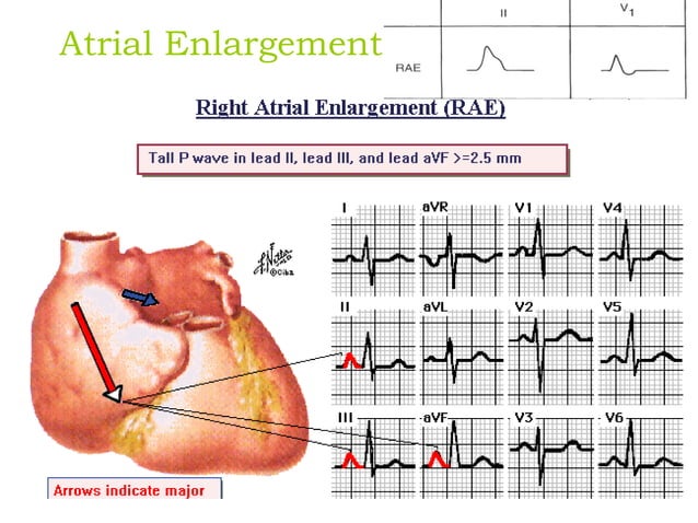 Ecg skills enhancement | PPT