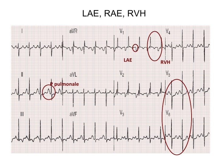 Ecg skills enhancement