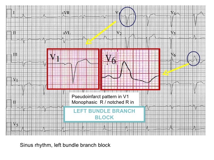 Ecg skills enhancement