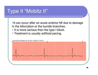 Ecg step by step not by me | PPTX