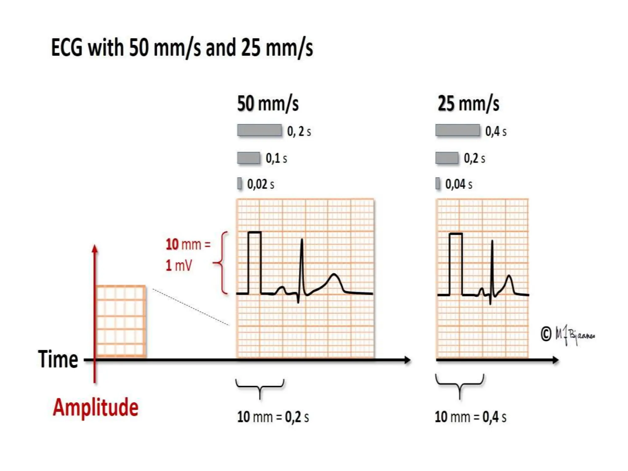 ECG STEPS,10 STEPS IN ECG INTERPRETATION | PPTX
