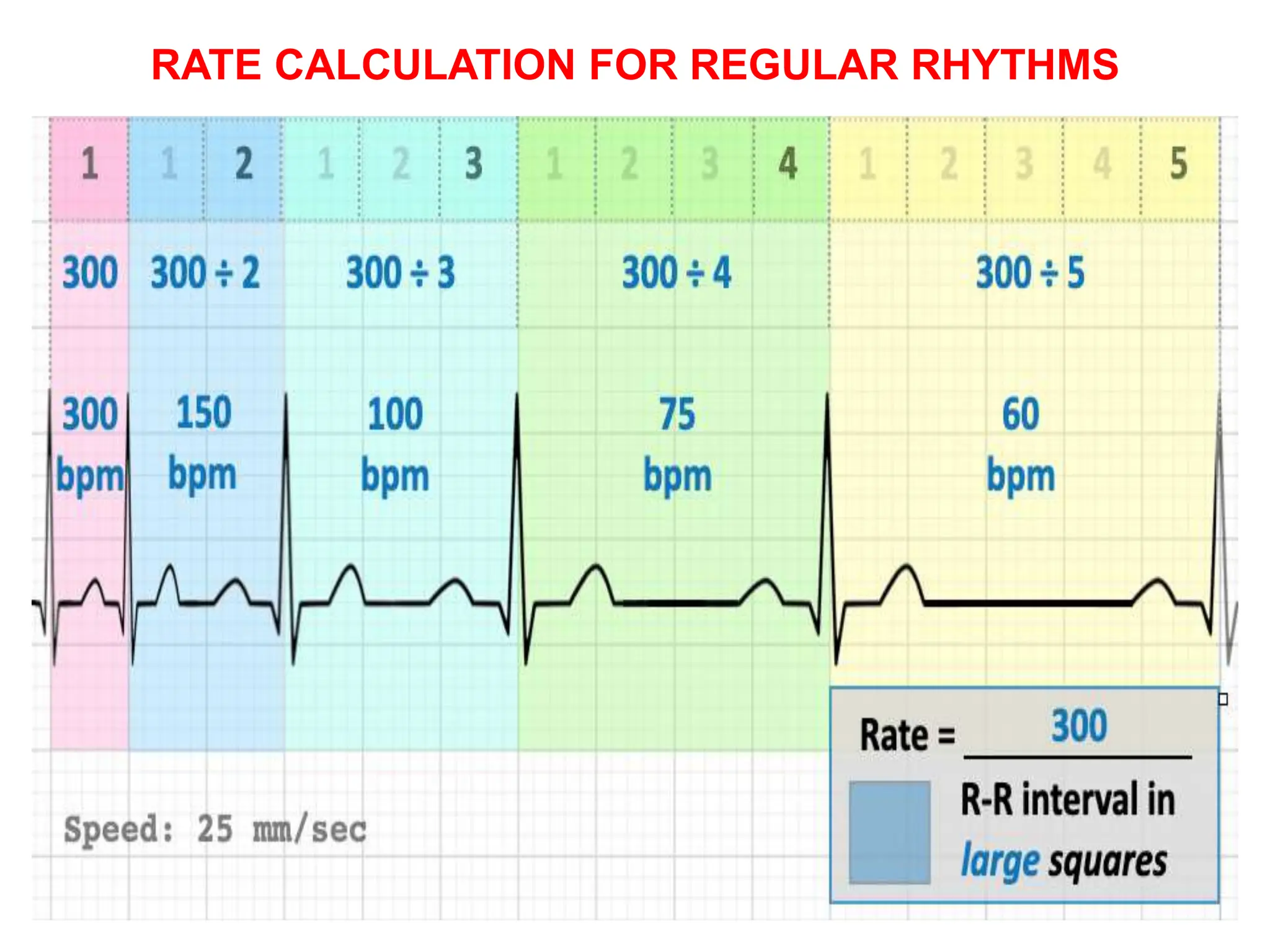 ECG STEPS,10 STEPS IN ECG INTERPRETATION | PPTX