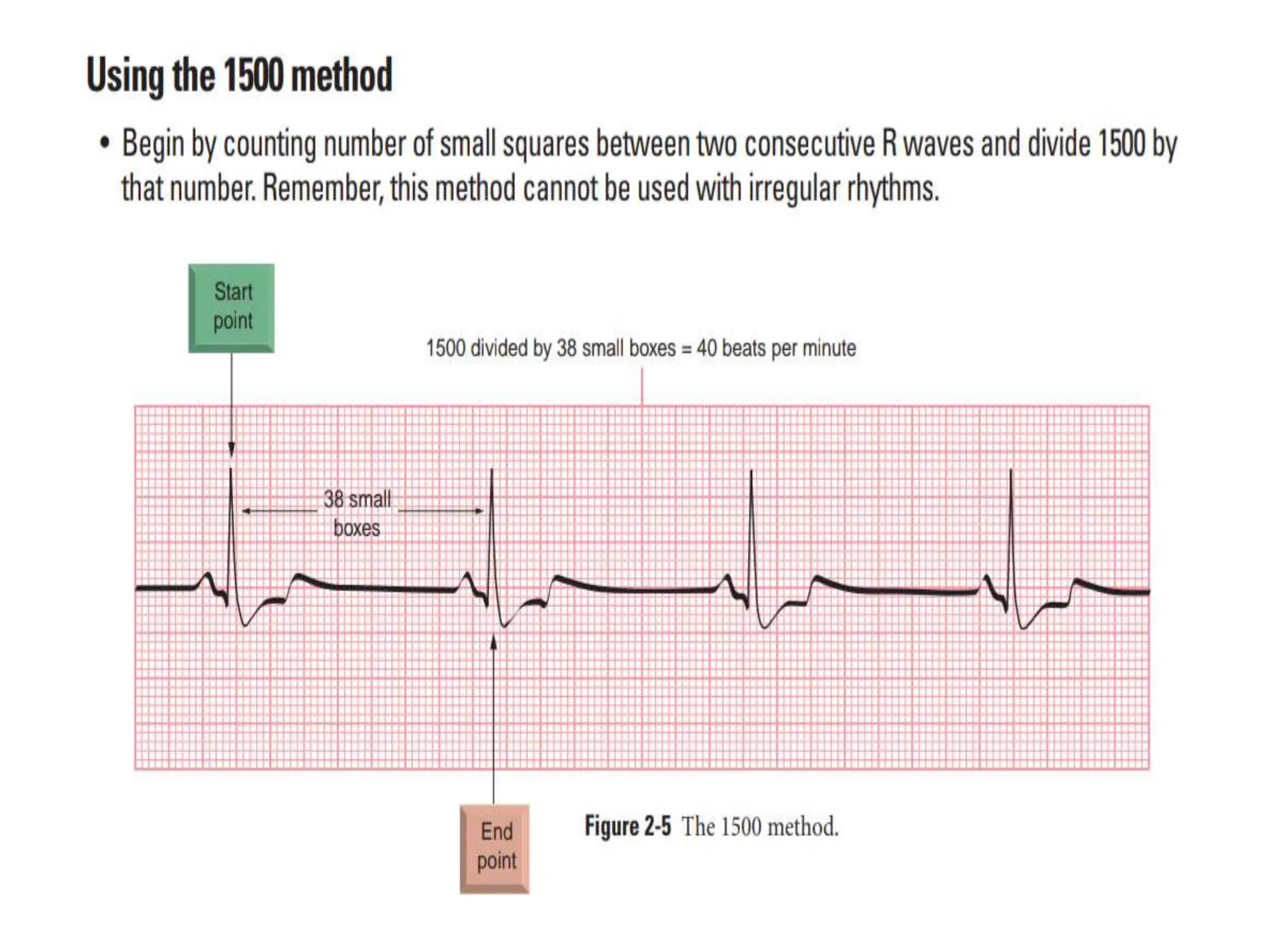 ECG STEPS,10 STEPS IN ECG INTERPRETATION | PPT