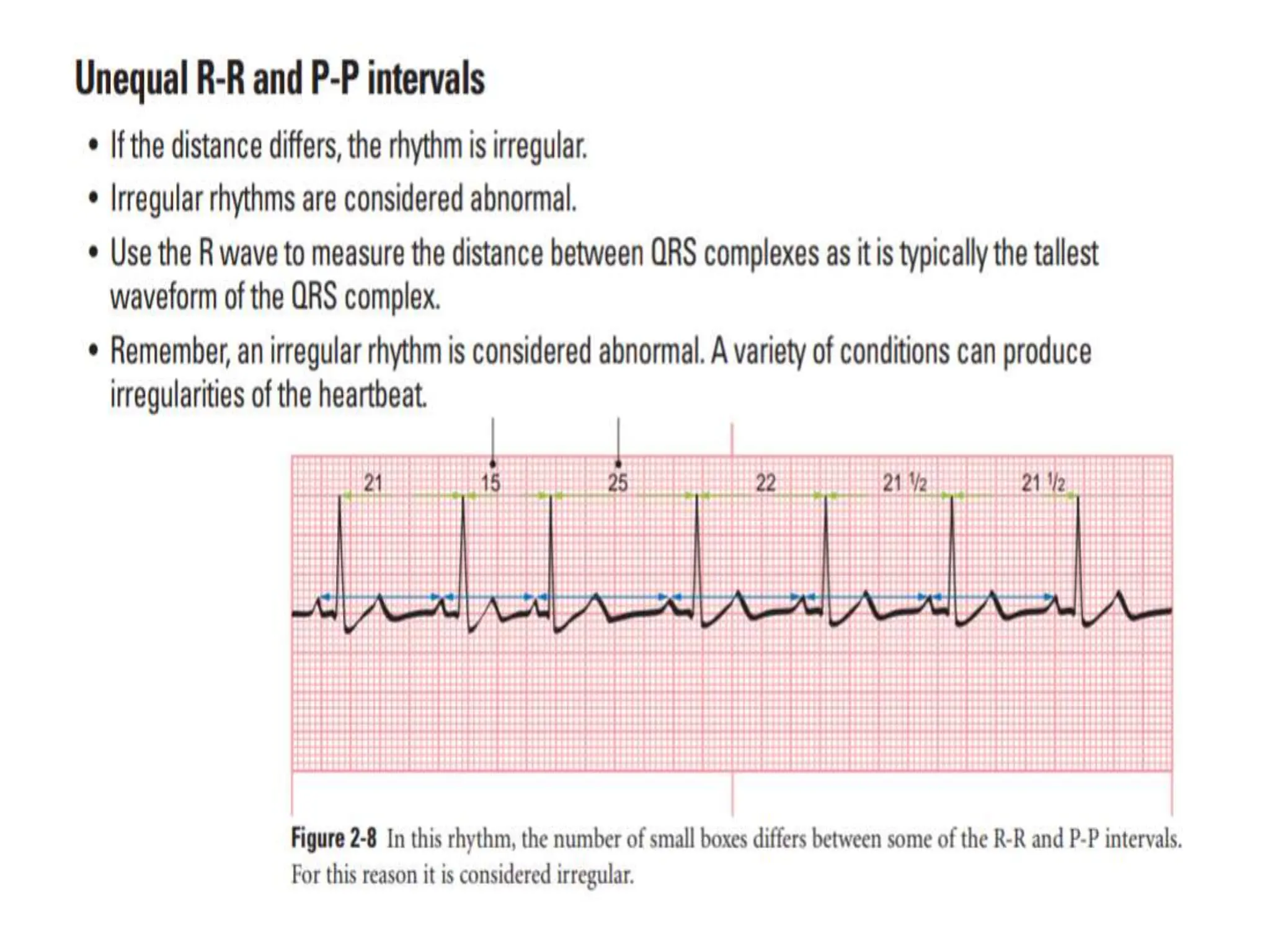 ECG STEPS,10 STEPS IN ECG INTERPRETATION | PPTX