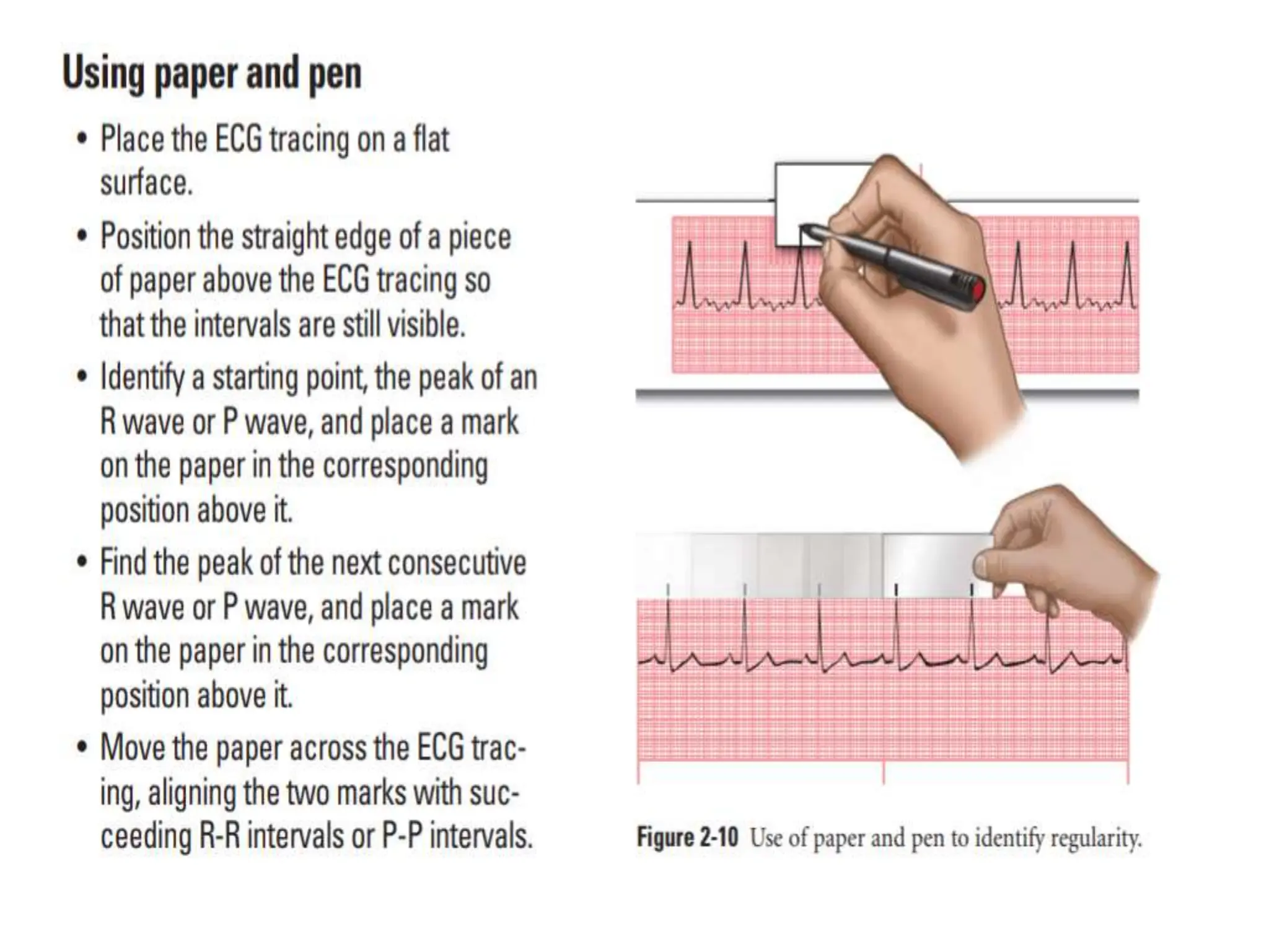 ECG STEPS,10 STEPS IN ECG INTERPRETATION | PPTX