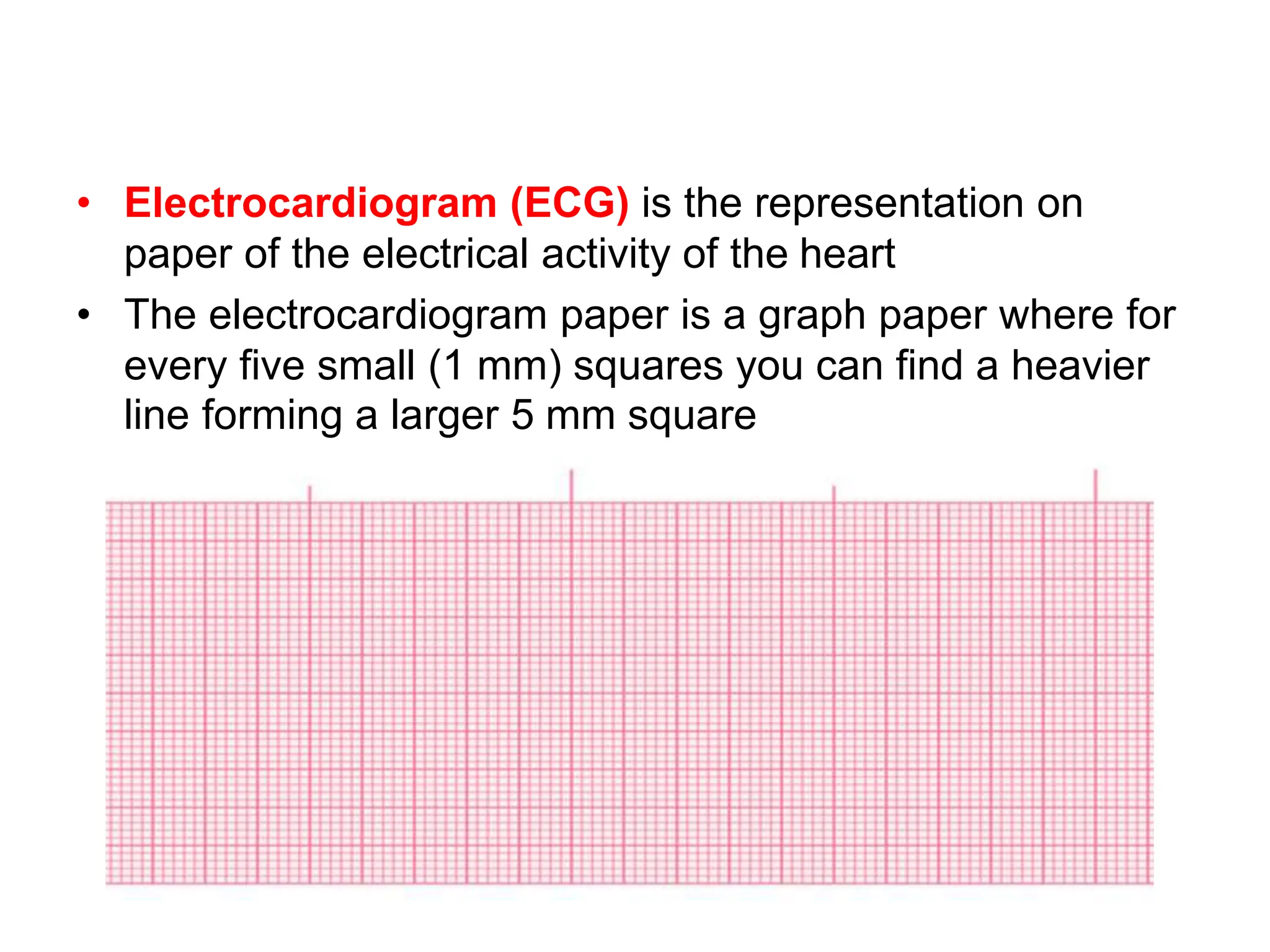 ECG STEPS,10 STEPS IN ECG INTERPRETATION | PPT