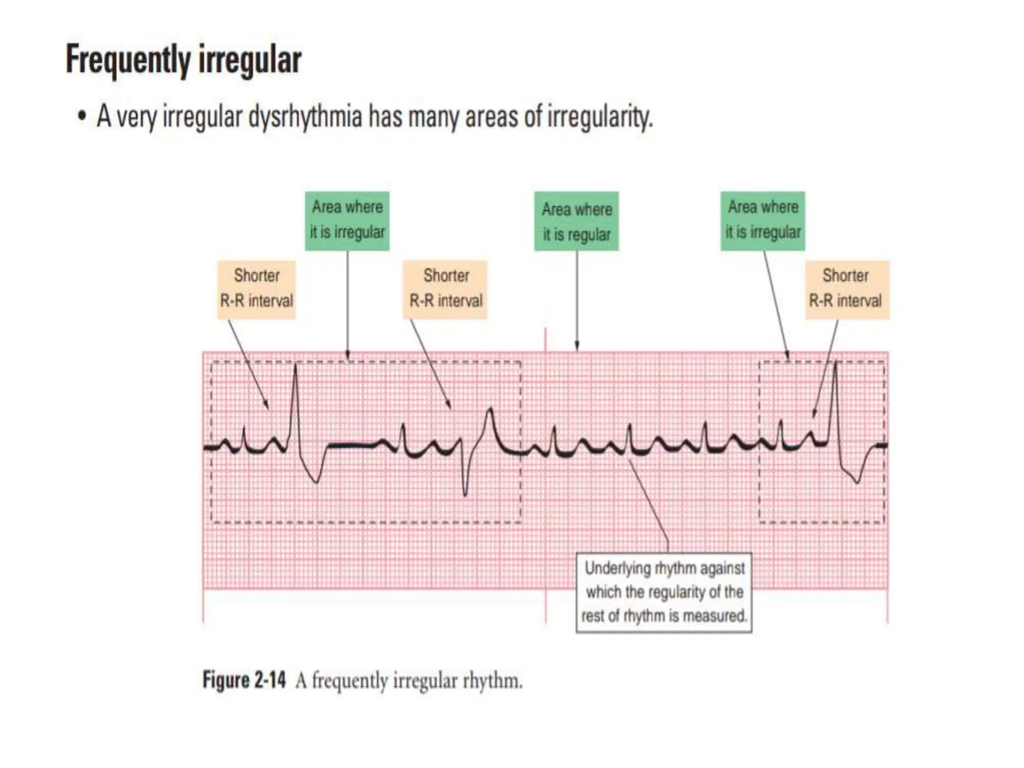 ECG STEPS,10 STEPS IN ECG INTERPRETATION | PPT