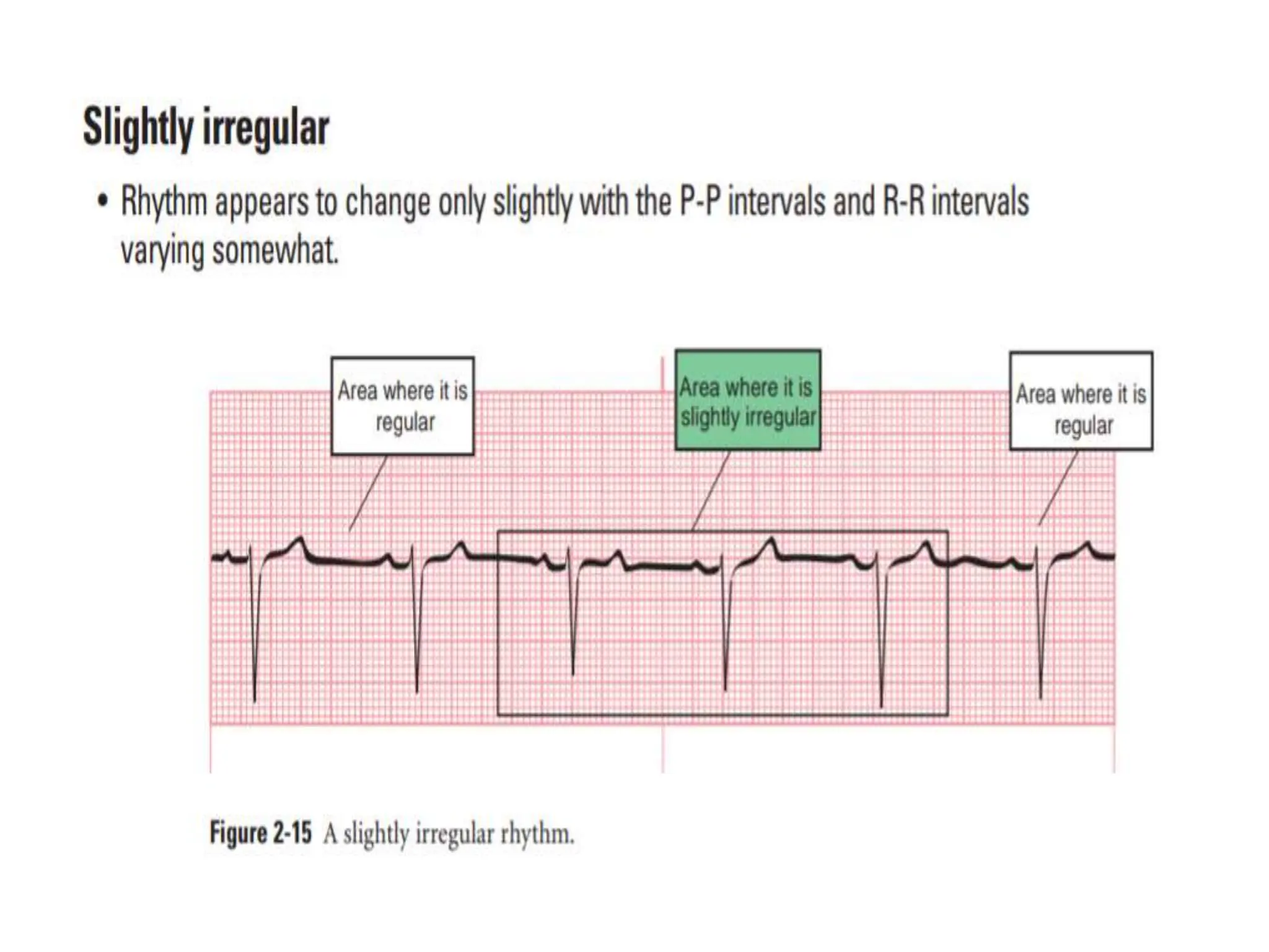 ECG STEPS,10 STEPS IN ECG INTERPRETATION | PPTX