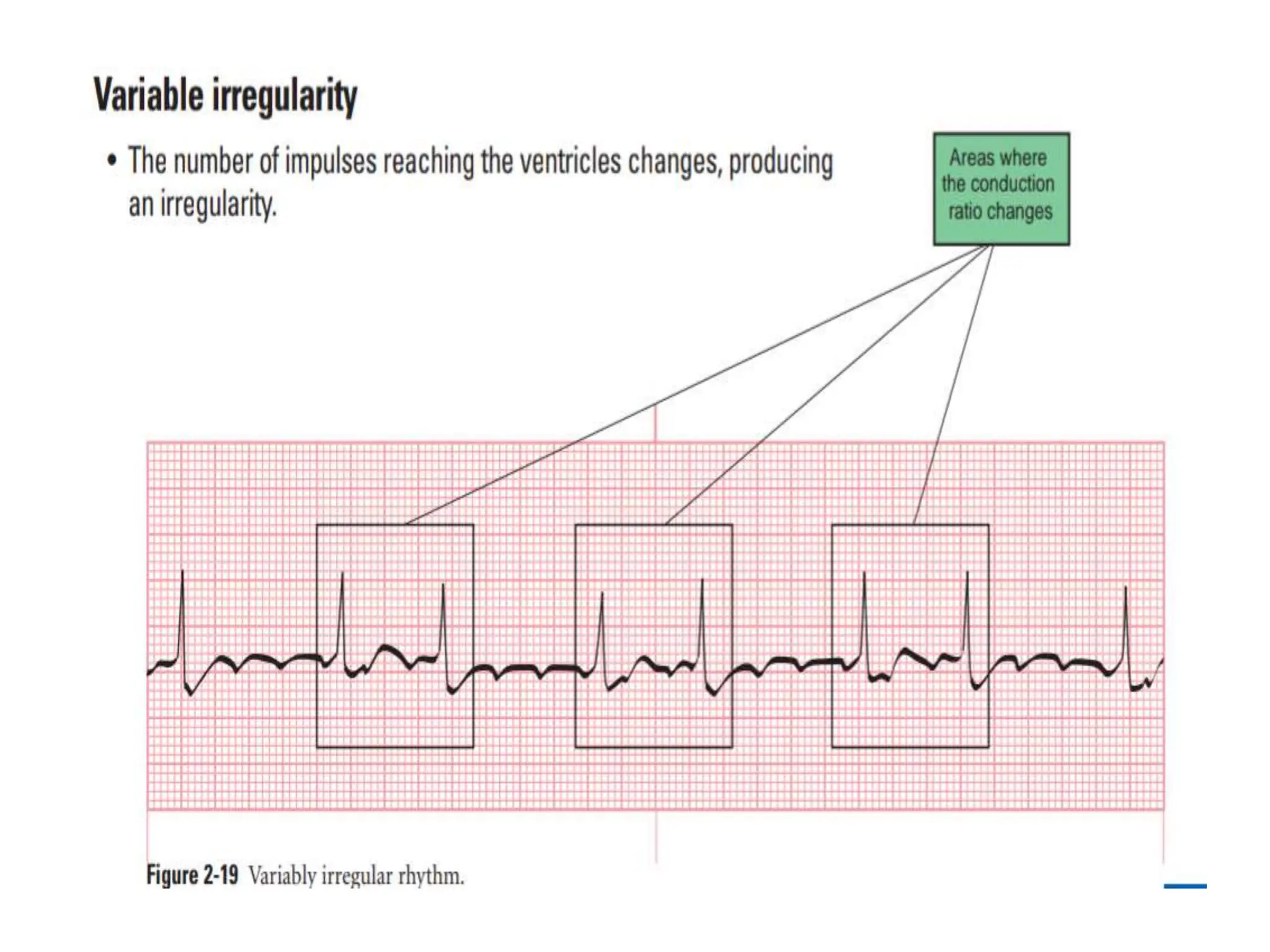 ECG STEPS,10 STEPS IN ECG INTERPRETATION | PPT