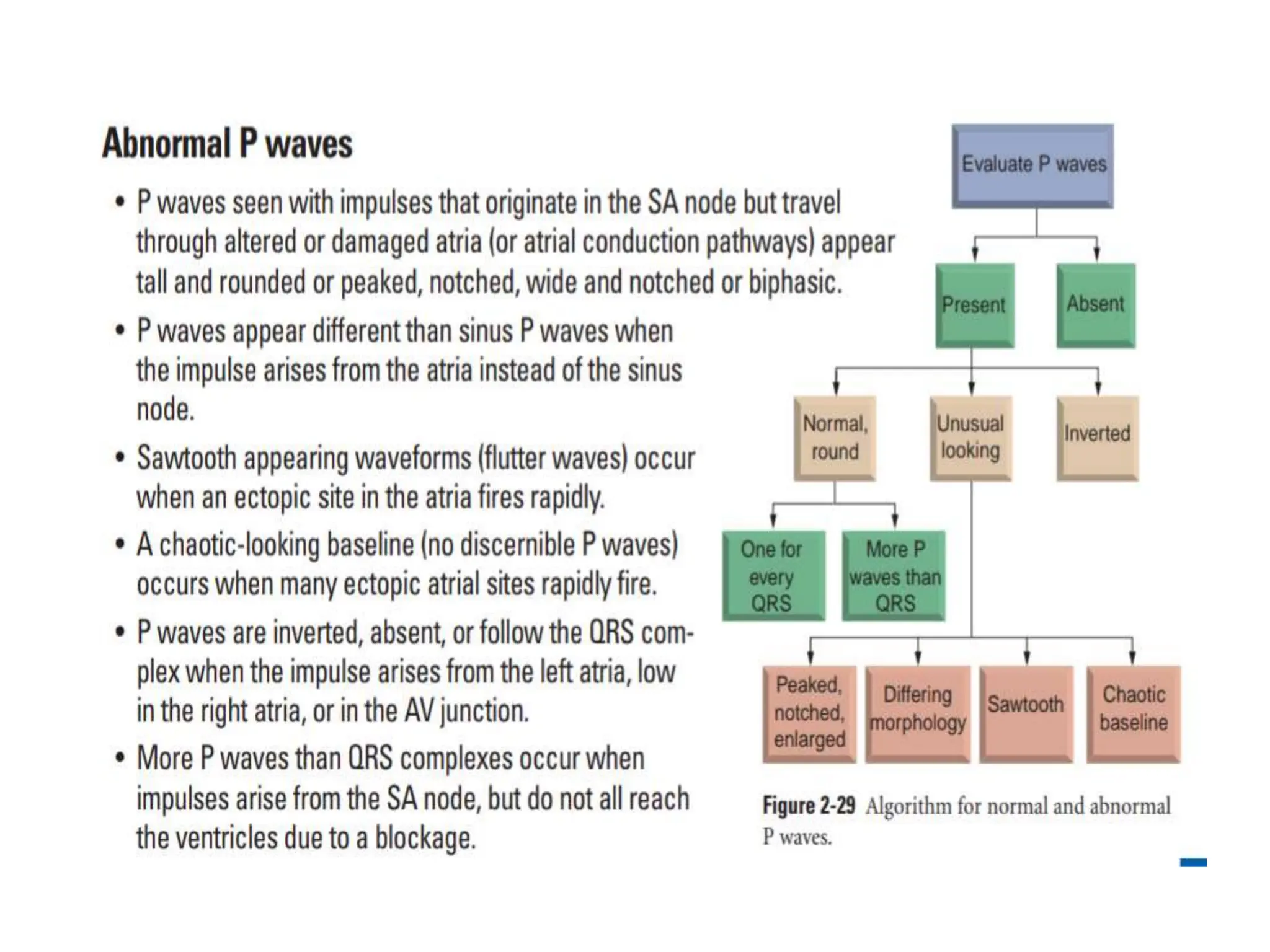 ECG STEPS,10 STEPS IN ECG INTERPRETATION | PPTX