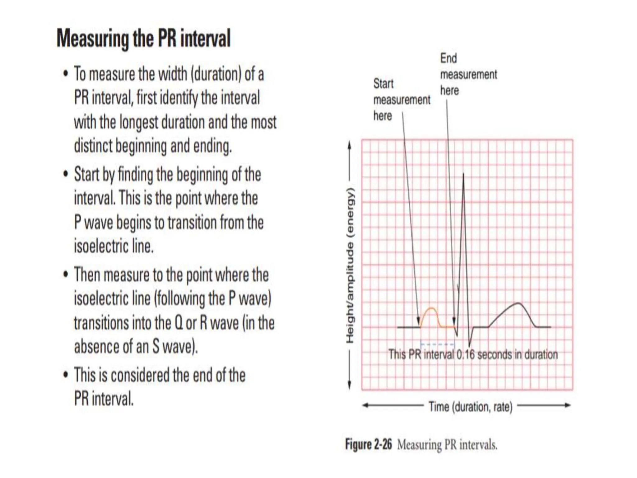 ECG STEPS,10 STEPS IN ECG INTERPRETATION | PPTX