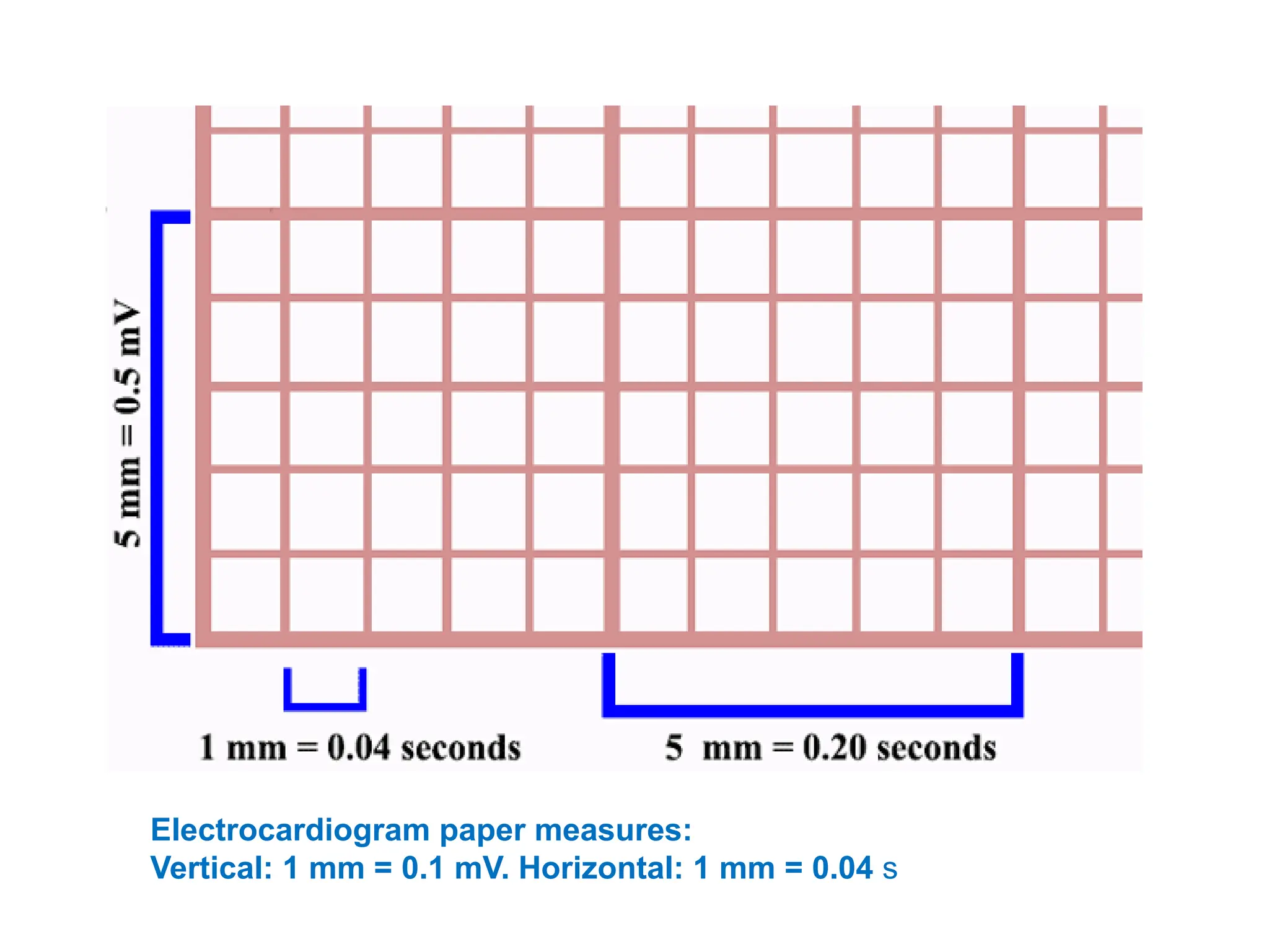 ECG STEPS,10 STEPS IN ECG INTERPRETATION | PPTX