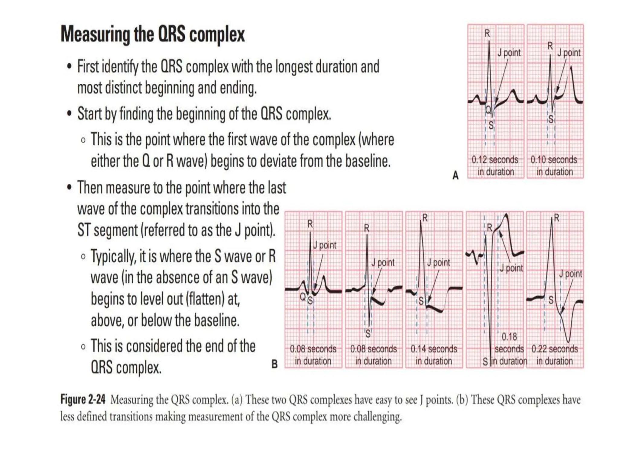 ECG STEPS,10 STEPS IN ECG INTERPRETATION | PPTX