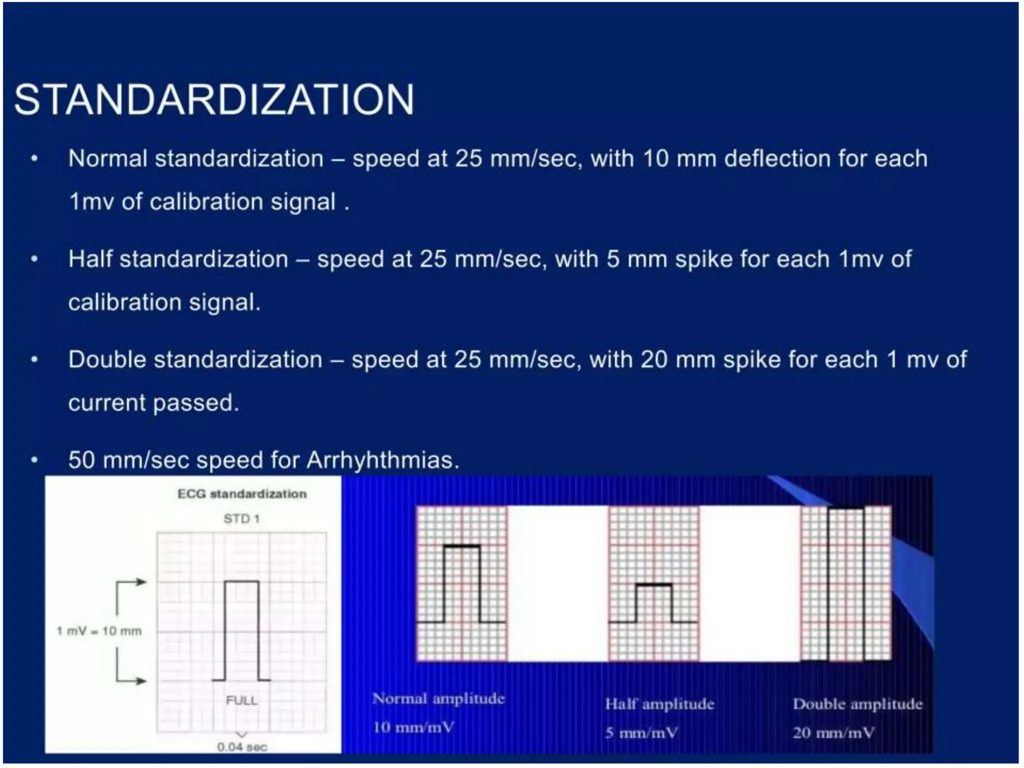 ECG STEPS,10 STEPS IN ECG INTERPRETATION | PPT