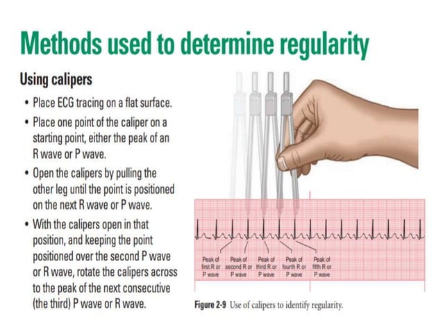 ECG STEPS,10 STEPS IN ECG INTERPRETATION | PPTX | Heart and ...