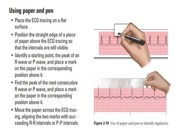 ECG STEPS,10 STEPS IN ECG INTERPRETATION | PPTX | Heart and ...