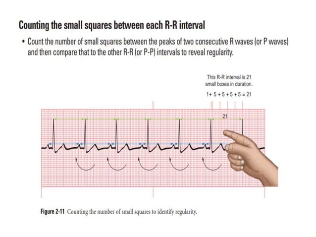 ECG STEPS,10 STEPS IN ECG INTERPRETATION | PPTX | Heart and ...