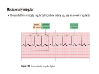 ECG STEPS,10 STEPS IN ECG INTERPRETATION | PPTX