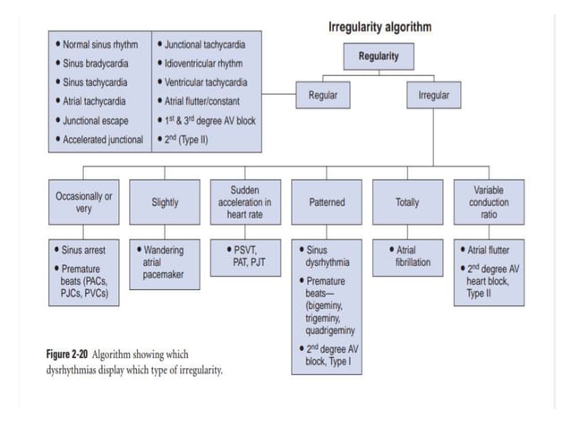 ECG STEPS,10 STEPS IN ECG INTERPRETATION | PPTX | Heart and ...