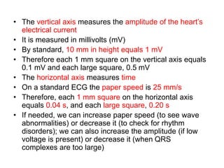 ECG STEPS,10 STEPS IN ECG INTERPRETATION | PPTX