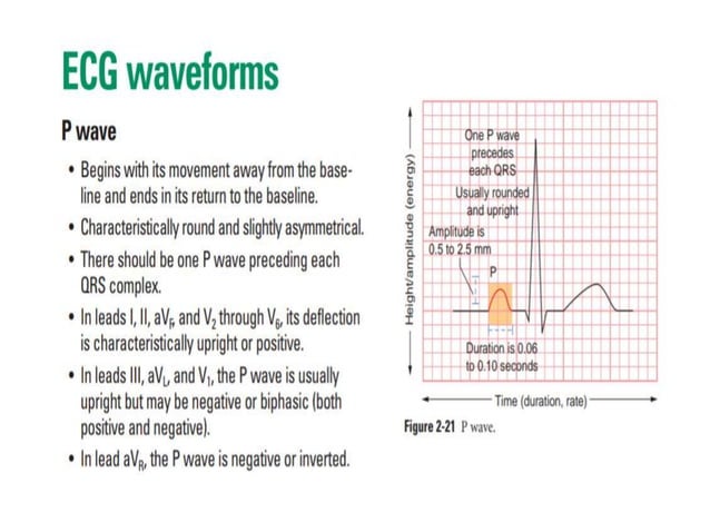 ECG STEPS,10 STEPS IN ECG INTERPRETATION | PPTX | Heart and ...