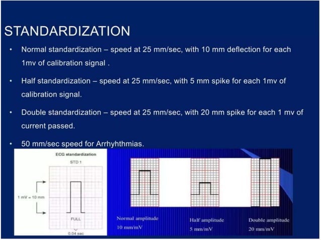 ECG STEPS,10 STEPS IN ECG INTERPRETATION | PPTX | Heart and ...