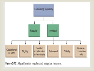 ECG STEPS AND ITS INTERPRETATION - Copy.pptx