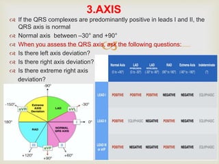 ECG STEPS AND ITS INTERPRETATION - Copy.pptx