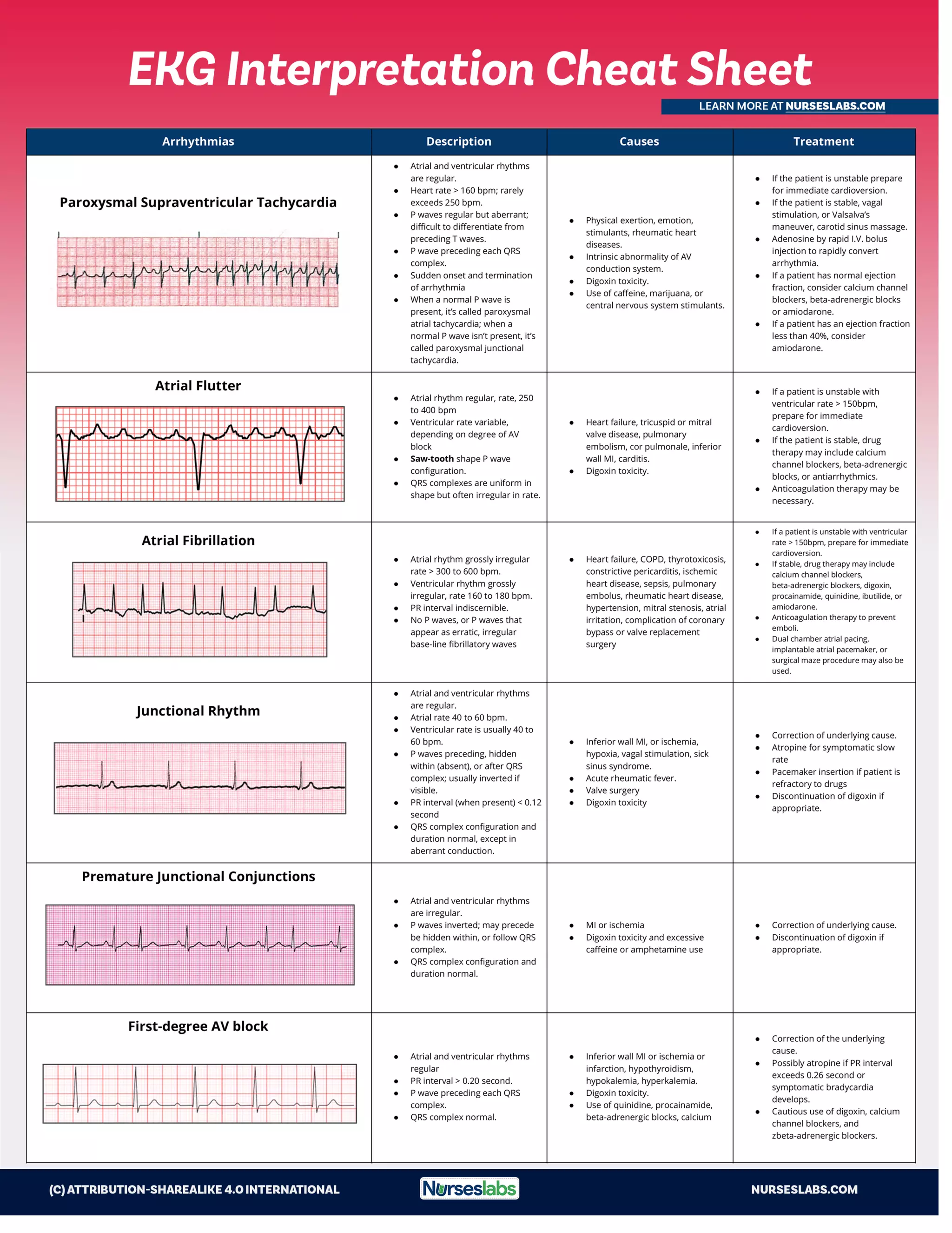 ECG summary.pdf