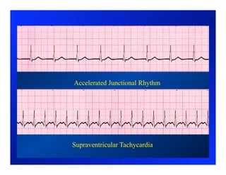 ecg_systemic_approach_12-lead_compressed.pdf