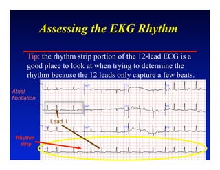 ecg_systemic_approach_12-lead_compressed.pdf