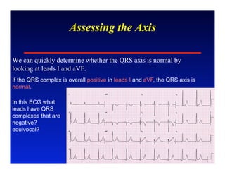 ecg_systemic_approach_12-lead_compressed.pdf