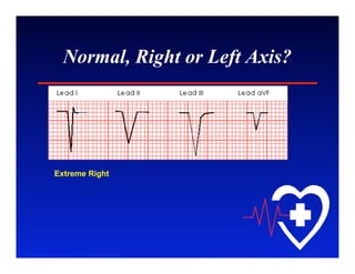ecg_systemic_approach_12-lead_compressed.pdf