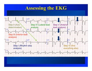 ecg_systemic_approach_12-lead_compressed.pdf