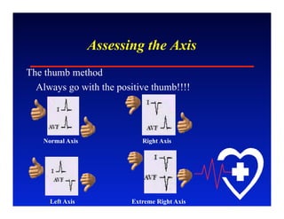 ecg_systemic_approach_12-lead_compressed.pdf