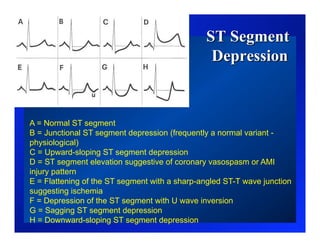 ecg_systemic_approach_12-lead_compressed.pdf