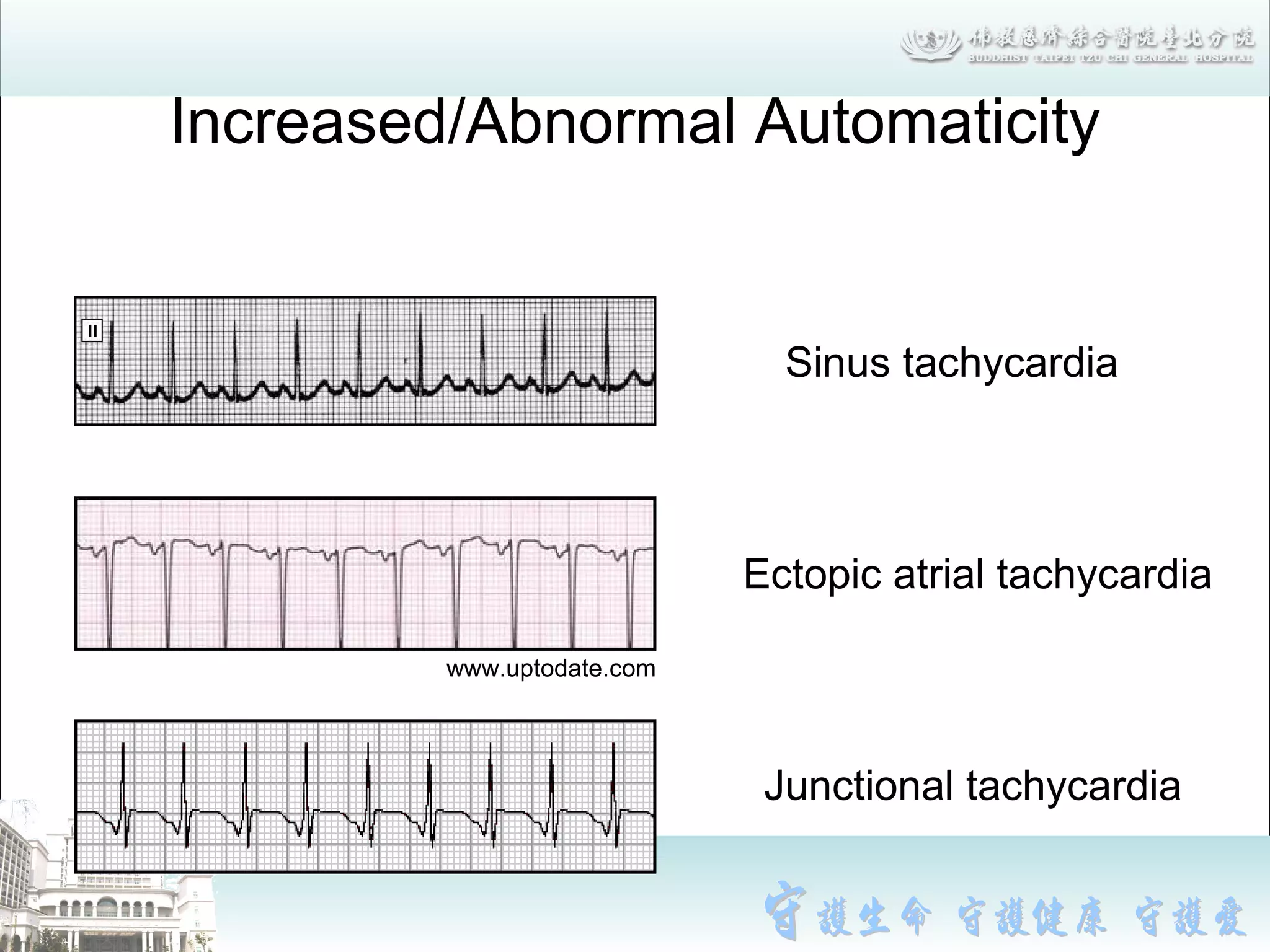 Arrhythmia: ECG-Tachycardia_20120909_中區 | PPT