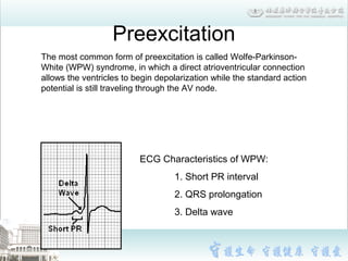 Arrhythmia: ECG-Tachycardia_20120909_中區 | PPT