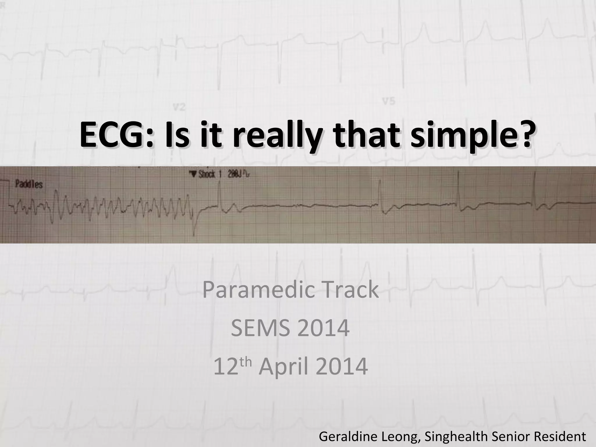 Geraldine Leong - ECG for paramedics | PPT