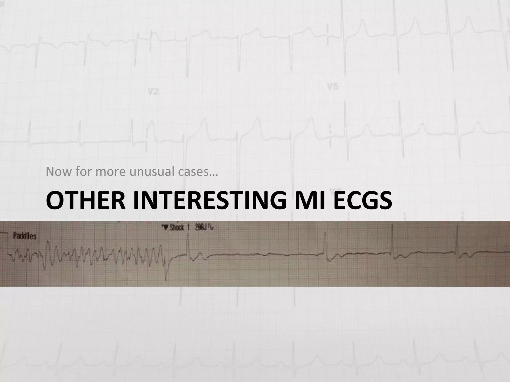 Geraldine Leong - ECG for paramedics | PPT