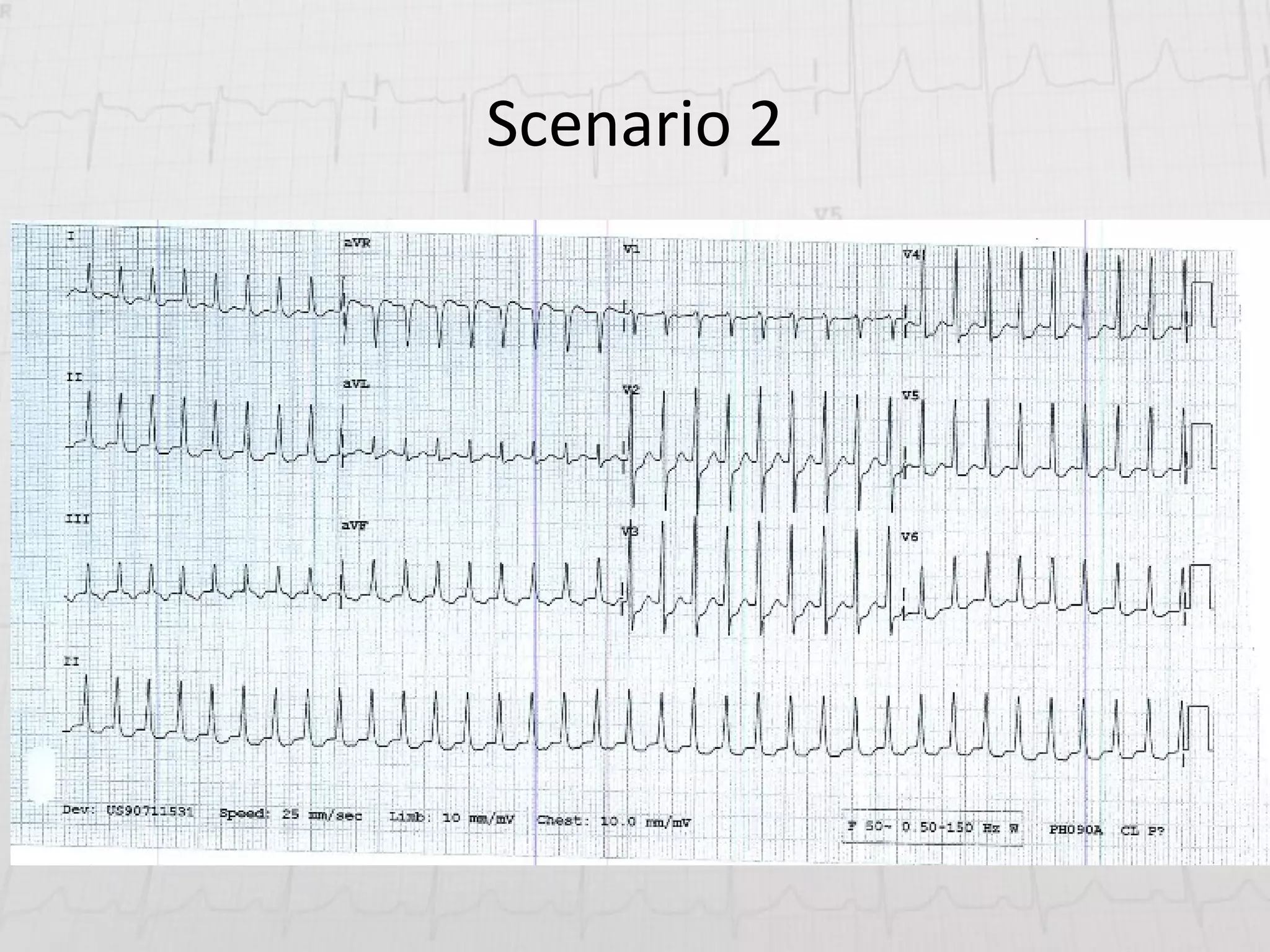 Geraldine Leong - ECG for paramedics | PPT