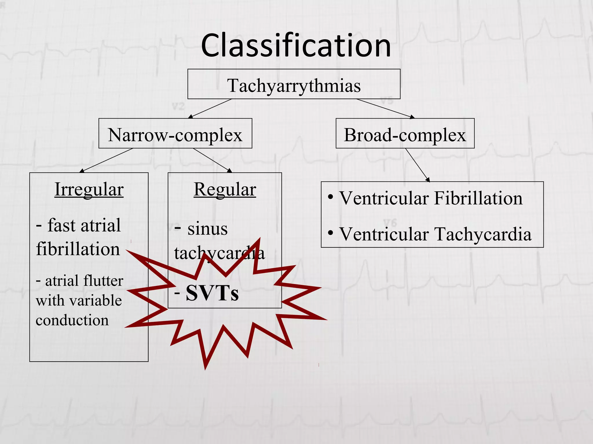 Geraldine Leong - ECG for paramedics | PPT