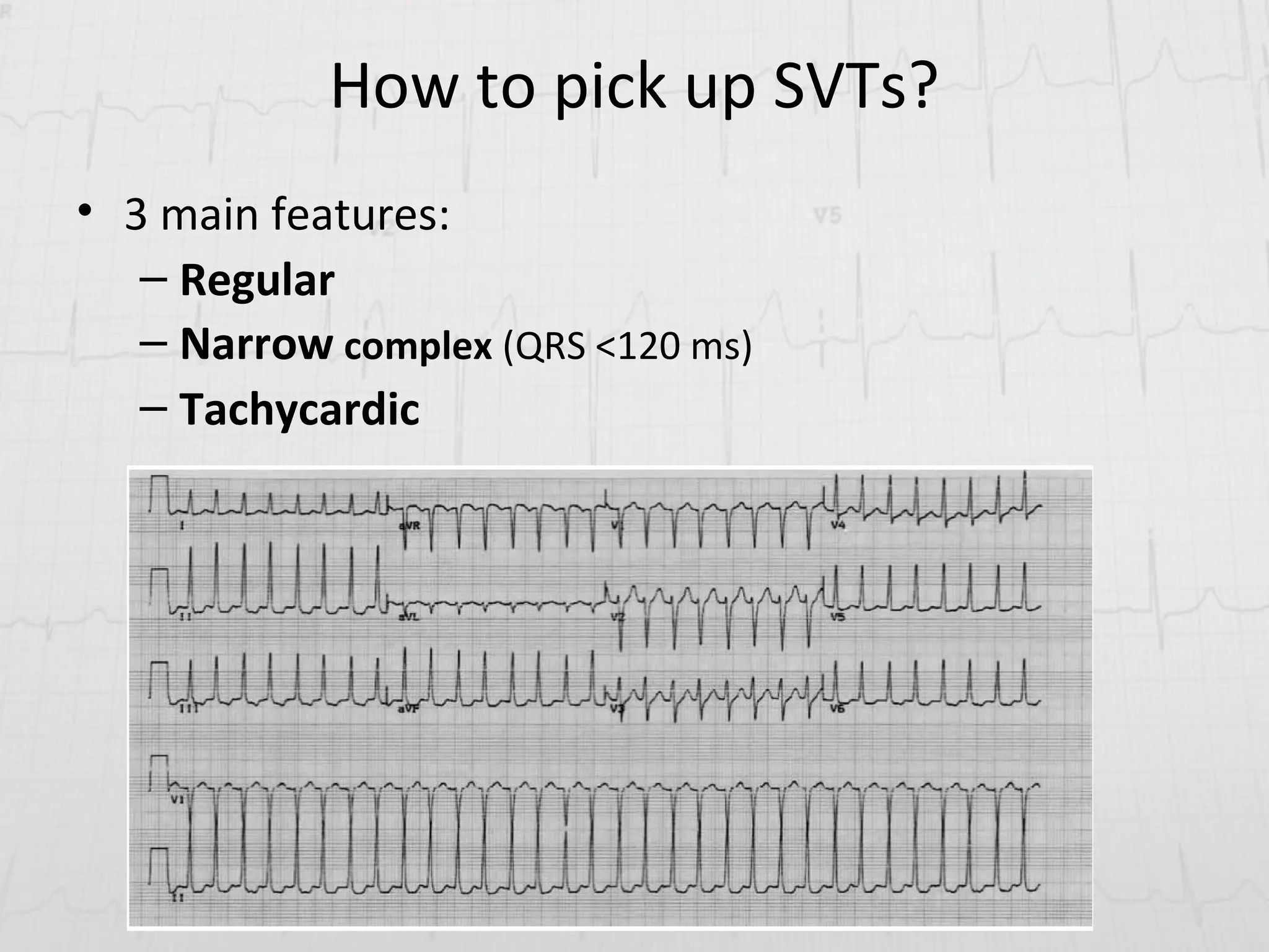 Geraldine Leong - ECG for paramedics | PPT