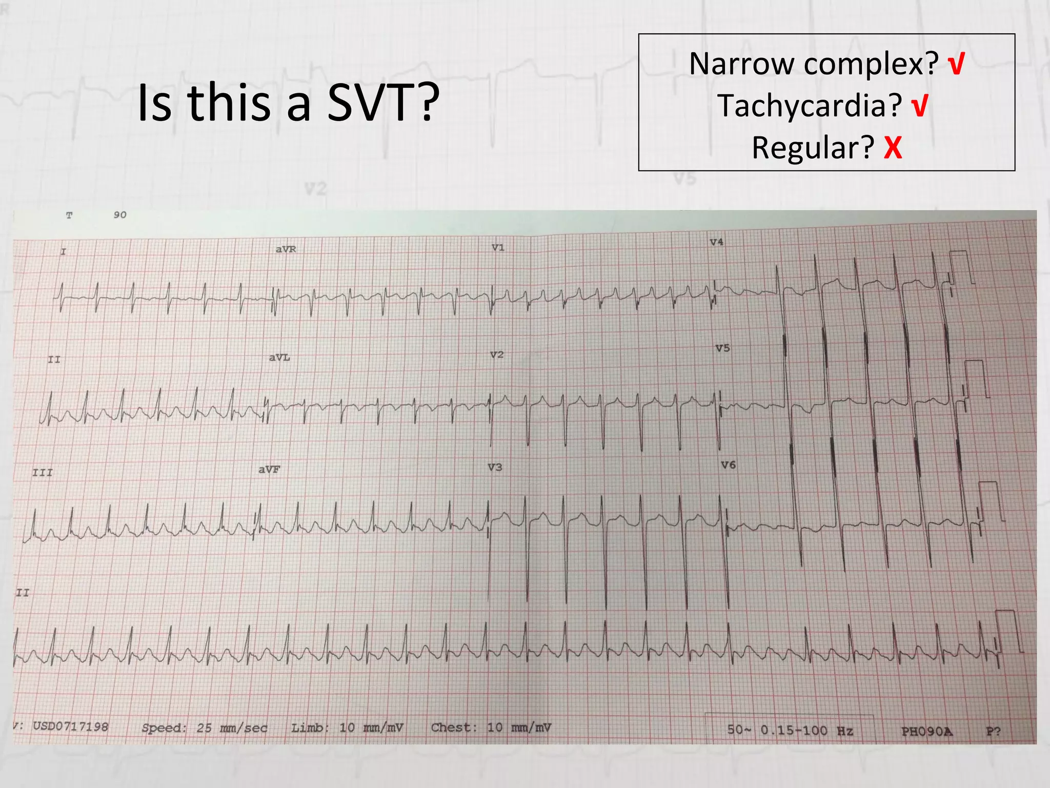 Geraldine Leong - ECG for paramedics | PPT