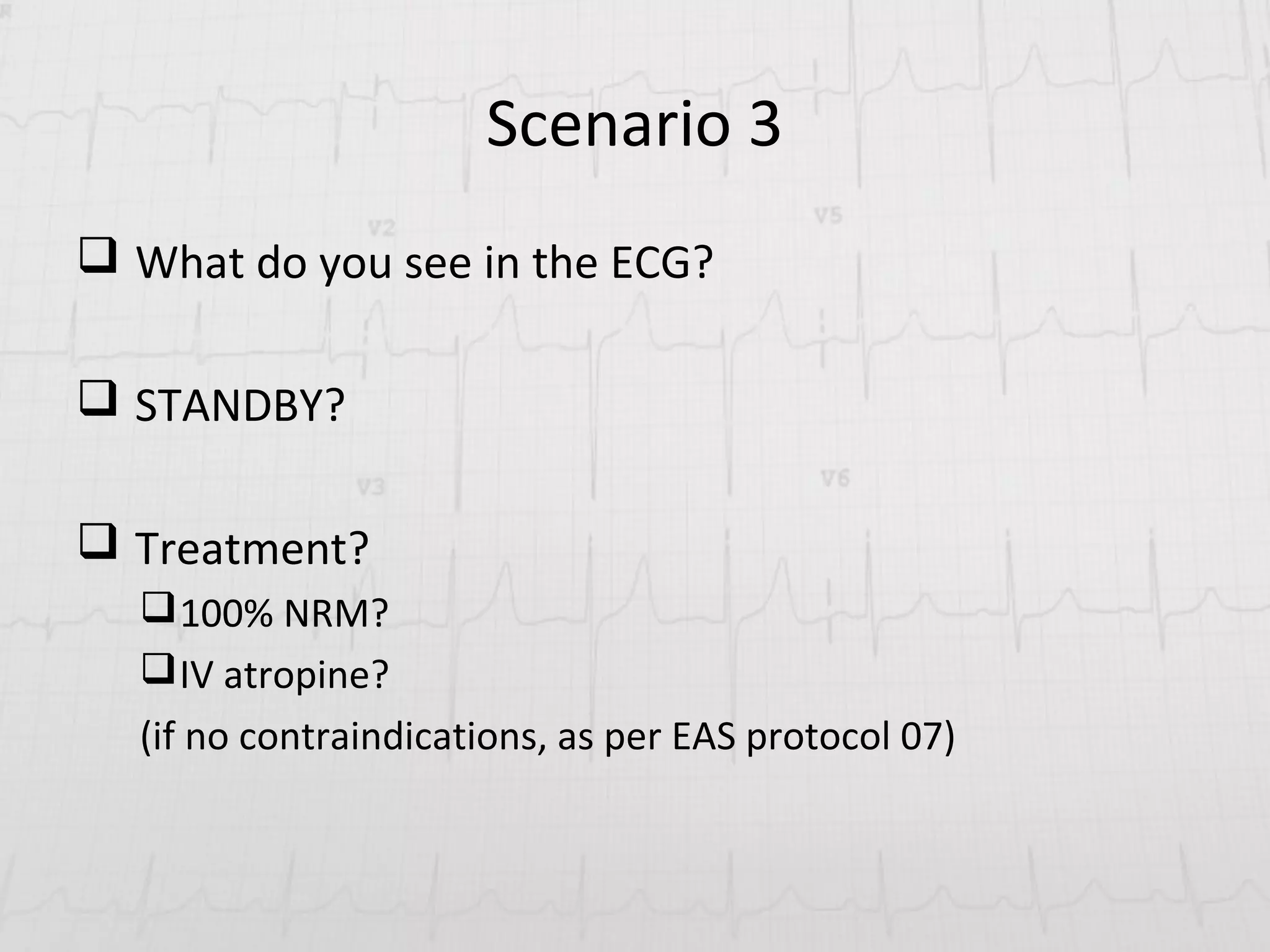 Geraldine Leong - ECG for paramedics | PPT