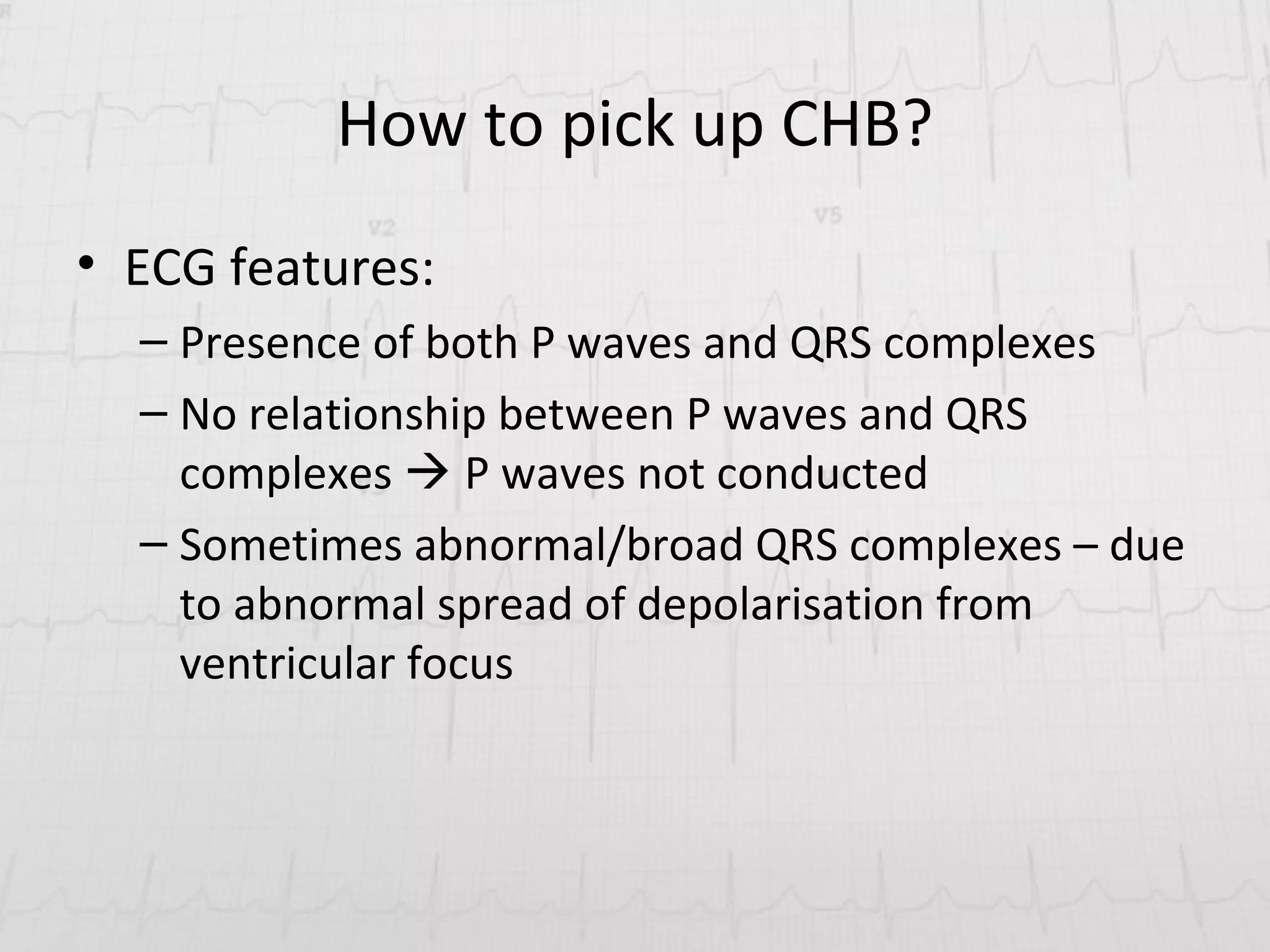 Geraldine Leong - ECG for paramedics | PPT
